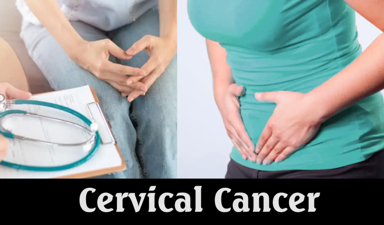 Understanding Cervical Cancer: A Silent Threat